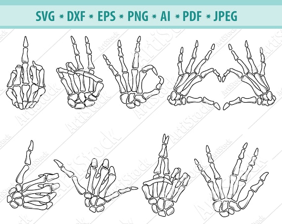 Menselijke Hand Tekent Botten Ziekte Van Dupuytren (Morbus Dupuytren