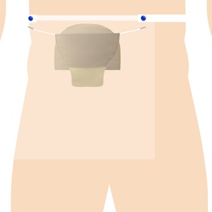 Ostomy Shower Guard: Speeds up Showering, Includes Travel Tube - Etsy