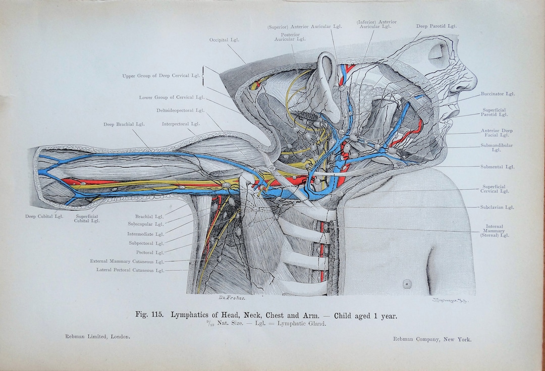 Antique Anatomy Print PAEDIATRIC LYMPHATIC SYSTEM Original Lithographed ...