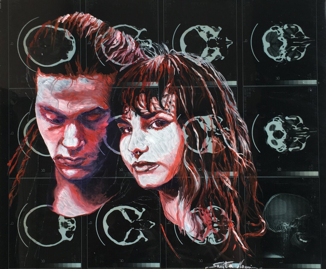 Romeo & Juliet - Portrait on X-ray Romantic Portrait Dark Art ...