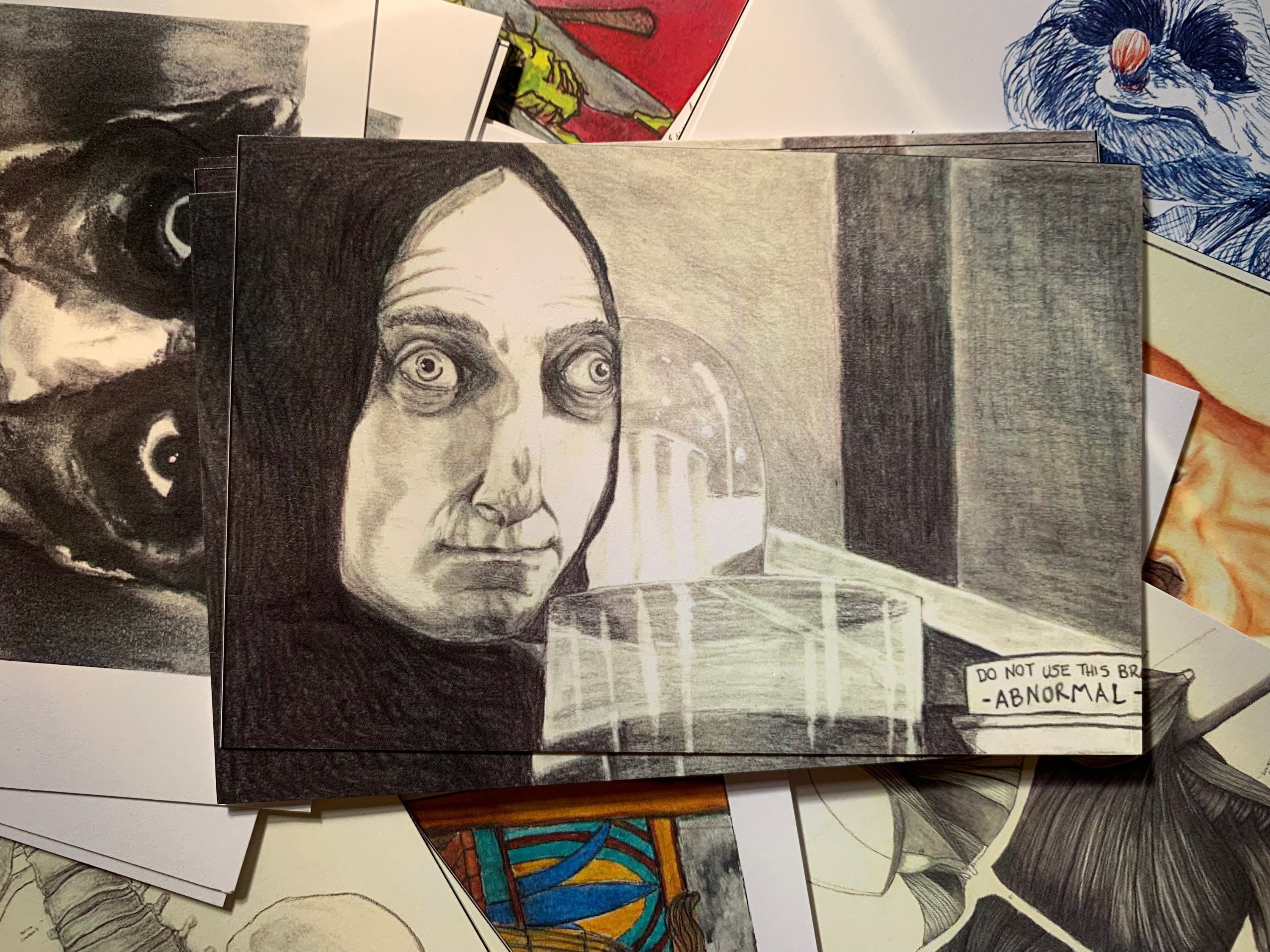 Young Frankenstein Abi Normal Prints Igor Martin Feldman Mel Brooks ...