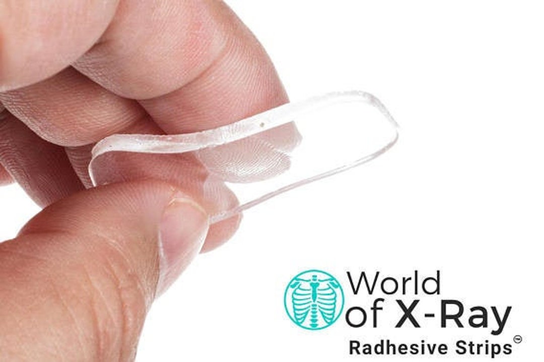 2 EXTRA STRONG X-ray Marker ADHESIVES, Fast Shipping, Radhesive ™ Holds ...