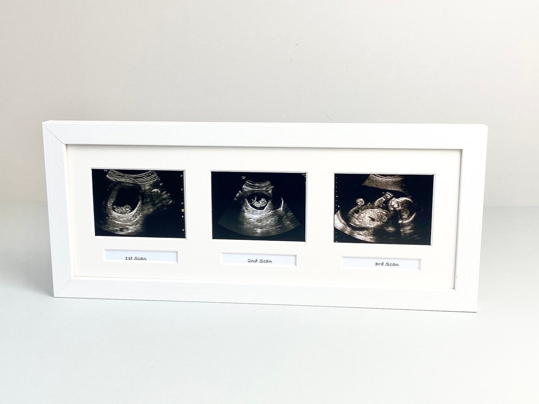Baby Scan Photo Frame - Multi Aperture Frame for Three Scan Sized ...