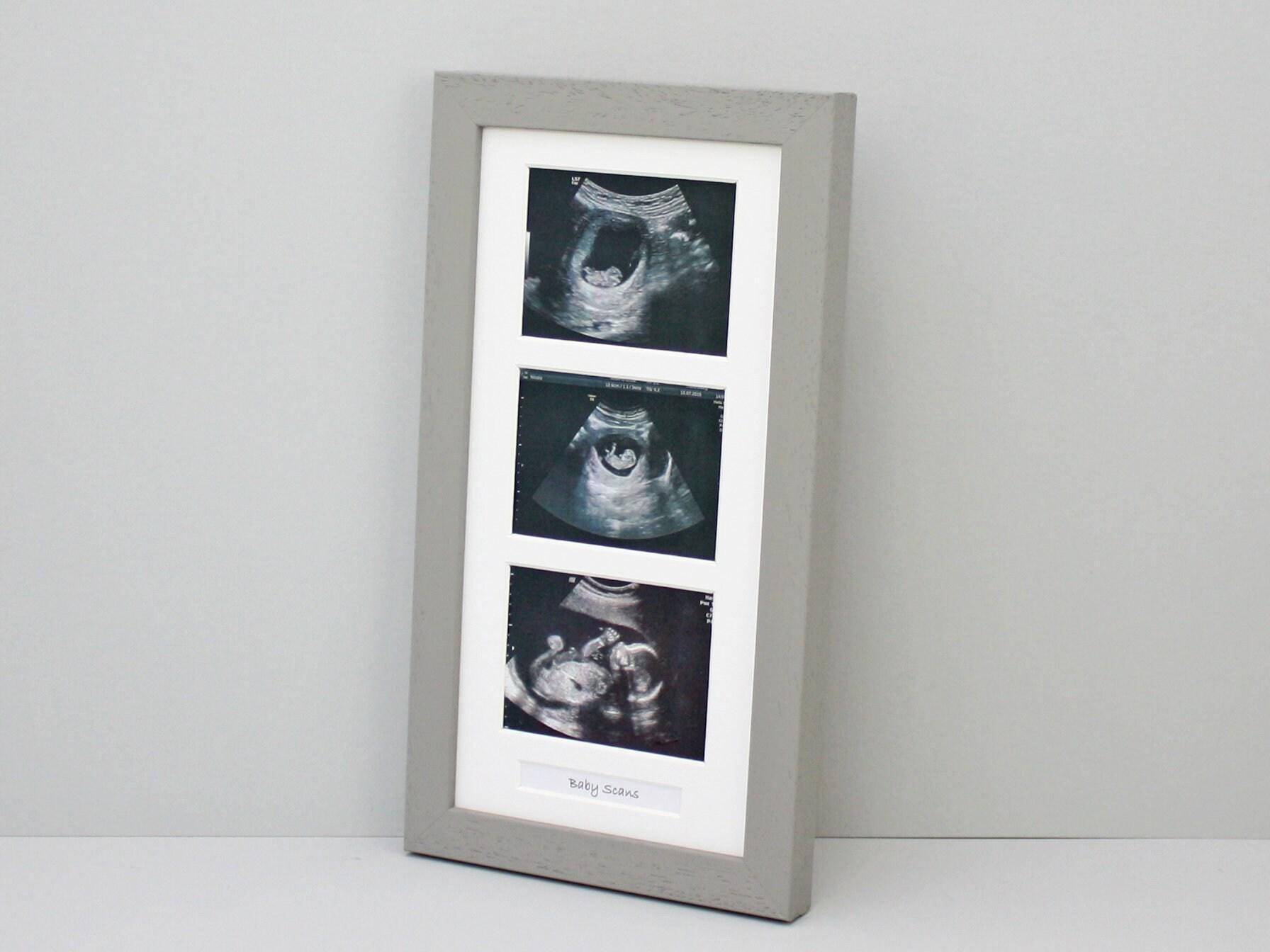 Baby Scan Photo Frame - Multi Aperture Frame for Three Scan Sized ...