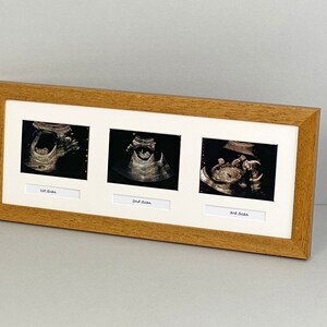 Baby Scan Photo Frame - Multi Aperture Frame for Three Scan Sized ...