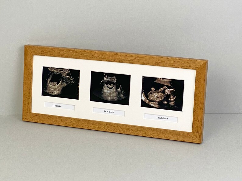 Baby Scan Photo Frame Multi Aperture Frame for Three Scan - Etsy UK