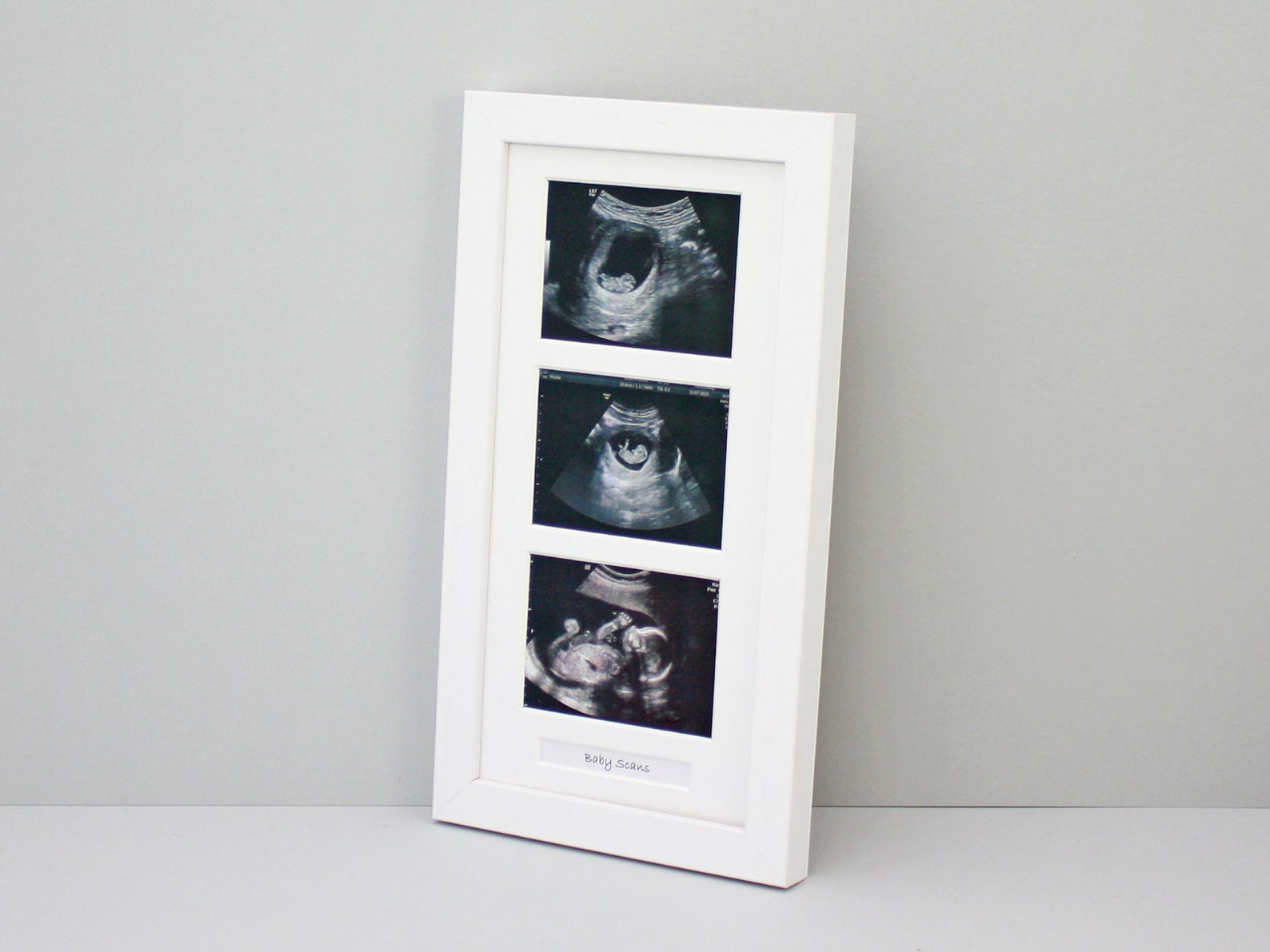 Baby Scan Photo Frame Multi Aperture Frame for Three Scan - Etsy UK