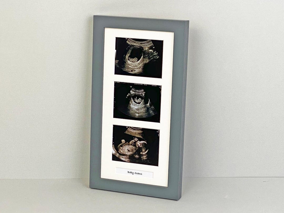 Baby Scan Photo Frame - Multi Aperture Frame for Three Scan Sized ...