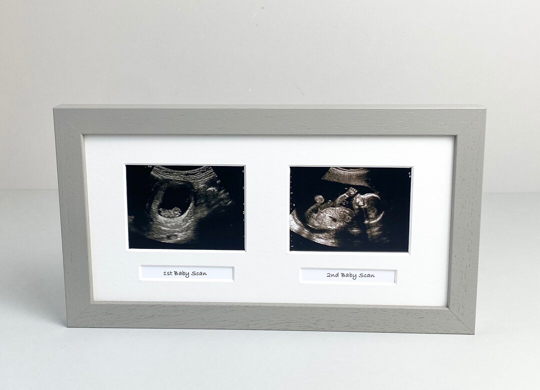 Baby Scan Photo Frame Multi Aperture Frame for Two Scan Sized Photos ...