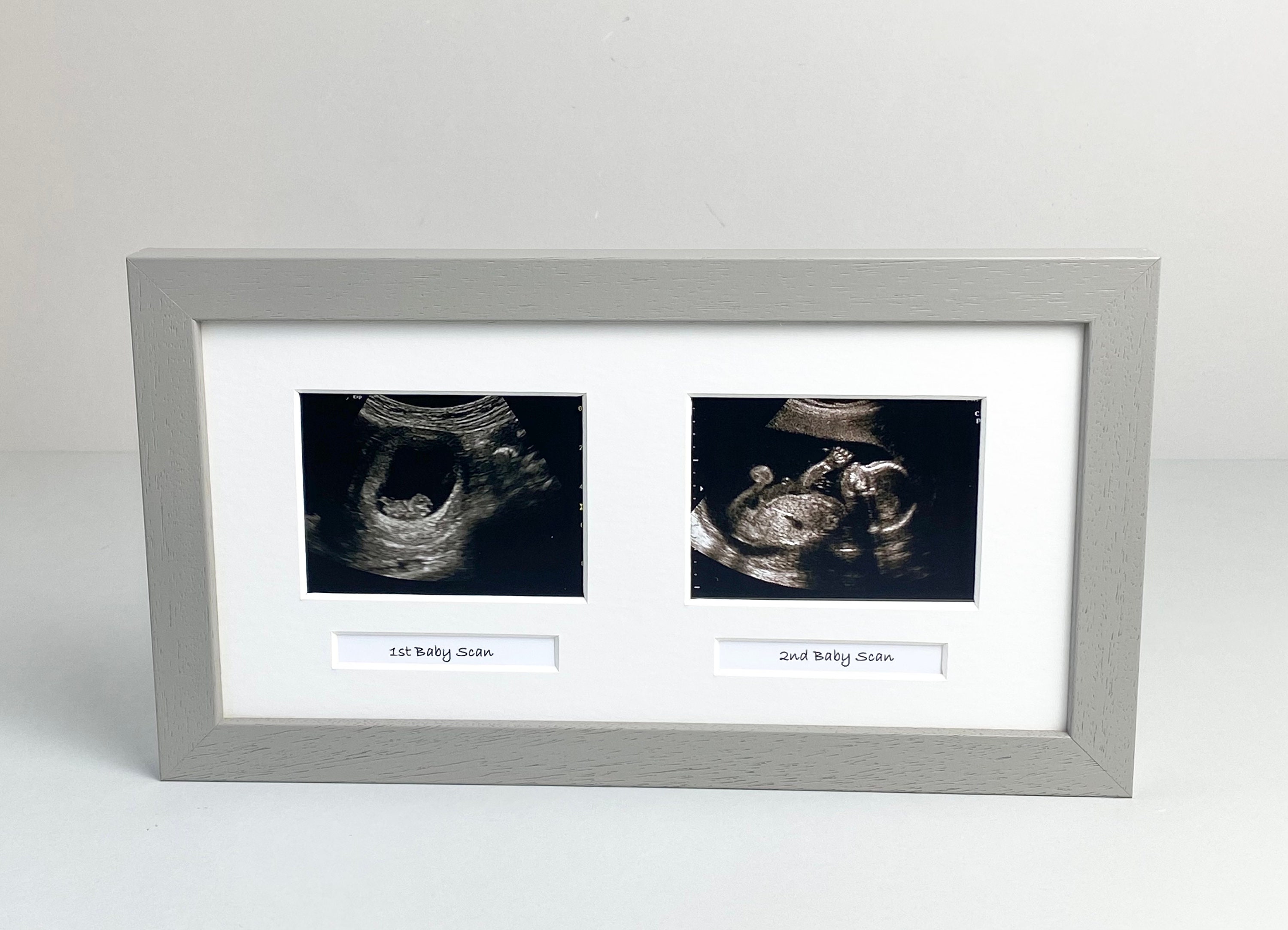 Baby Scan Photo Frame Multi Aperture Frame for Two Scan - Etsy UK