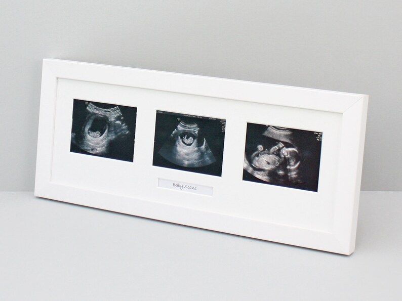 Baby Scan Photo Frame Multi Aperture Frame for Three Scan - Etsy UK