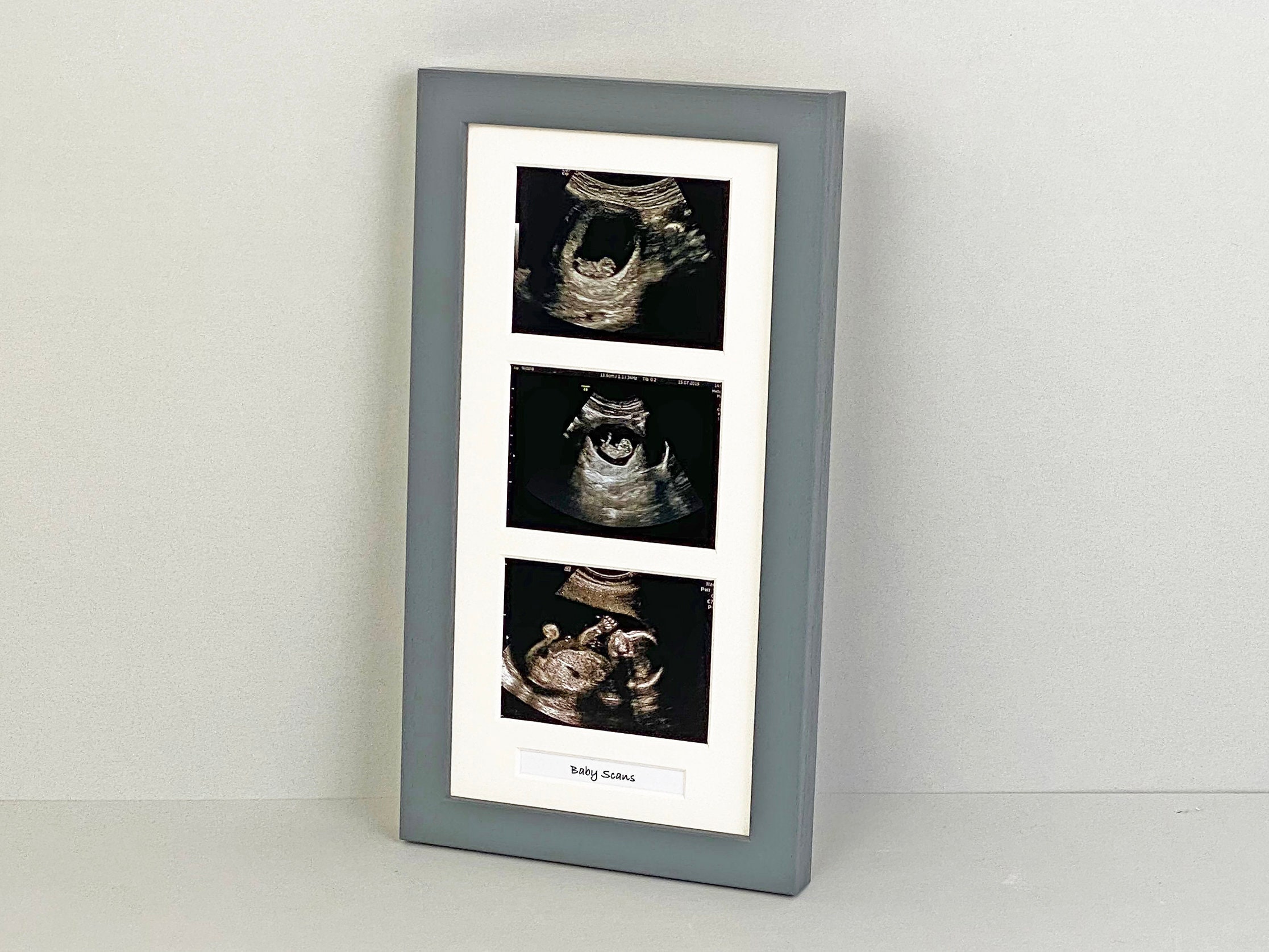 Baby Scan Photo Frame Multi Aperture Frame for Three Scan - Etsy UK