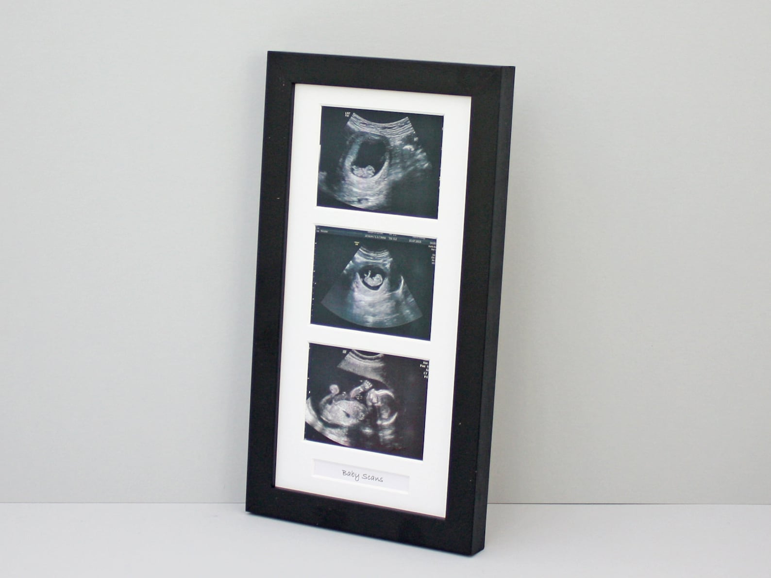 Baby Scan Photo Frame Multi Aperture Frame for Three Scan - Etsy UK