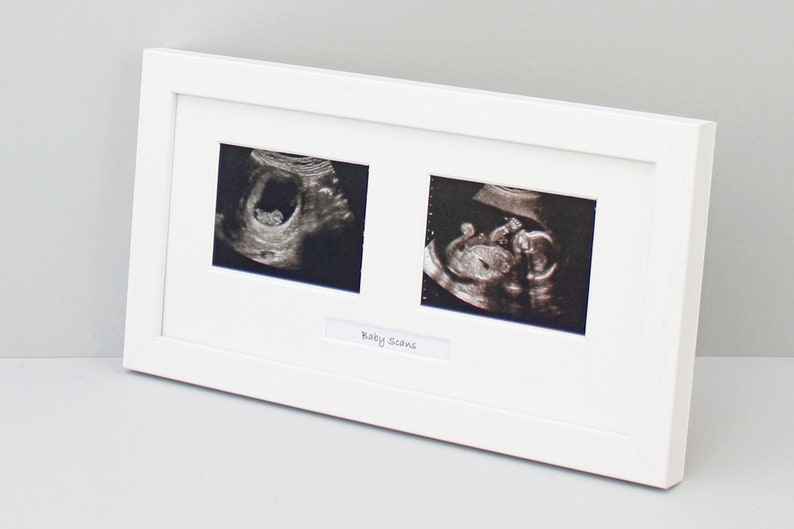 Baby Scan Photo Frame Multi Aperture Frame for Two Scan - Etsy Ireland
