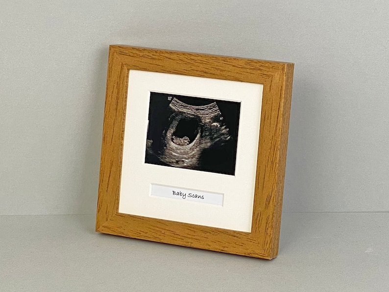 Baby Scan Photo Frame Multi Aperture Frame for Scan Sized - Etsy UK