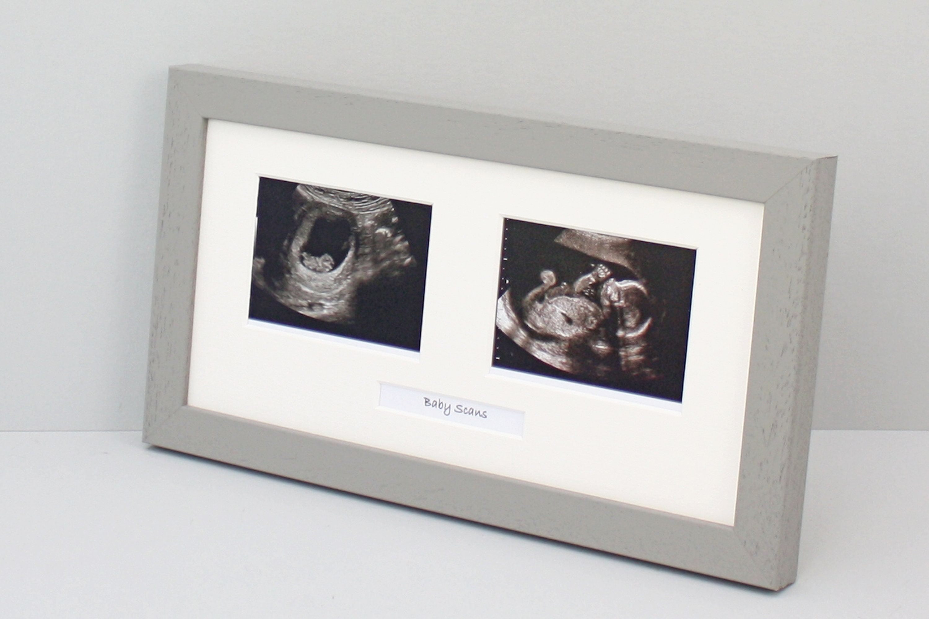 Baby Scan Photo Frame Multi Aperture Frame for Two Scan - Etsy UK