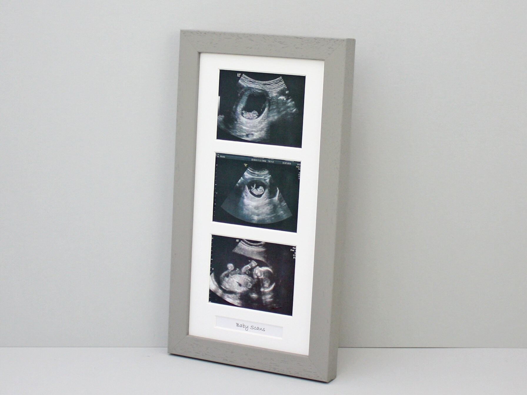 Baby Scan Photo Frame Multi Aperture Frame for Three Scan | Etsy