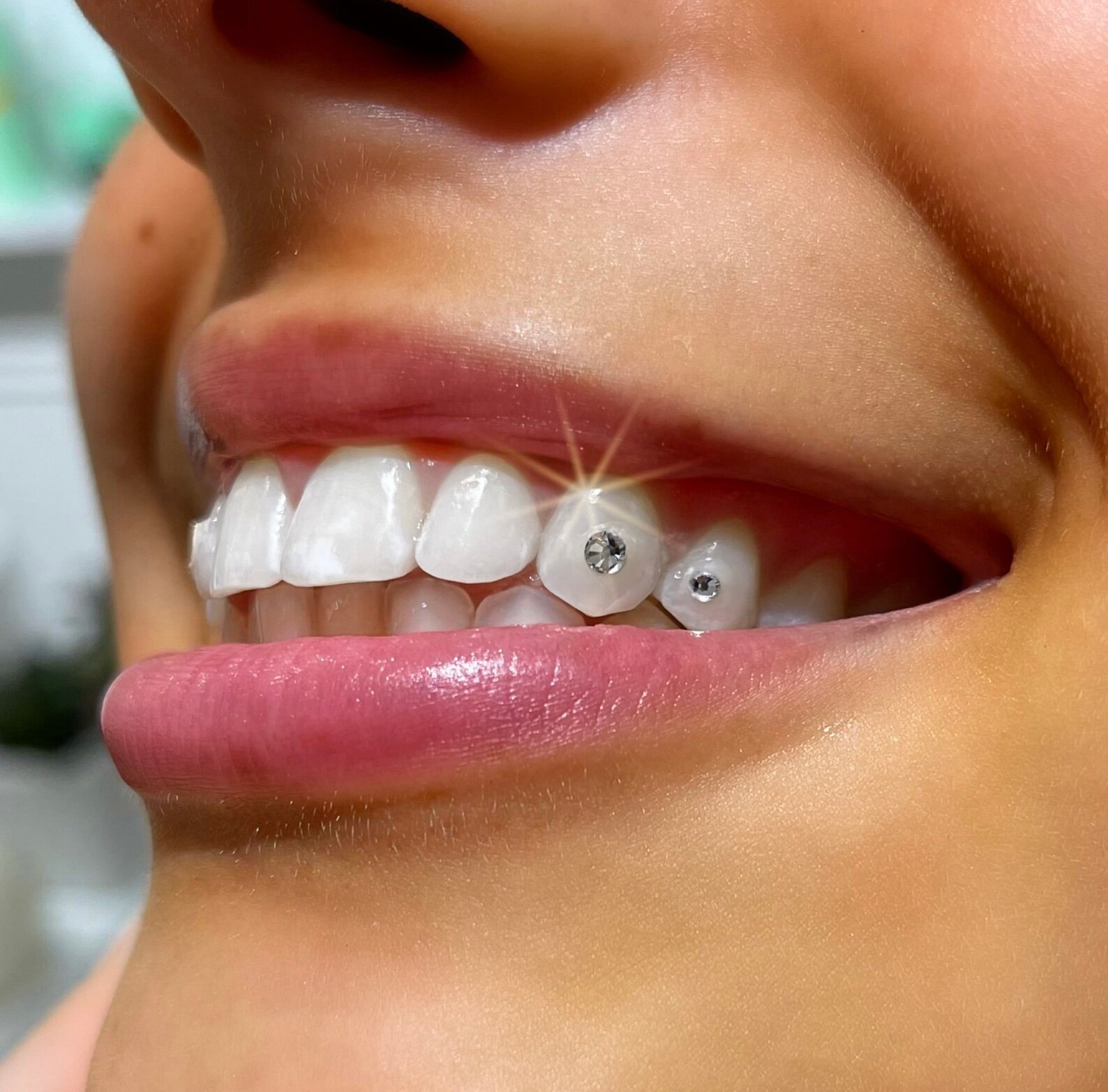 50 Piece Clear or Ab/rainbow Color Round Teeth Gems Preciosa® - Etsy