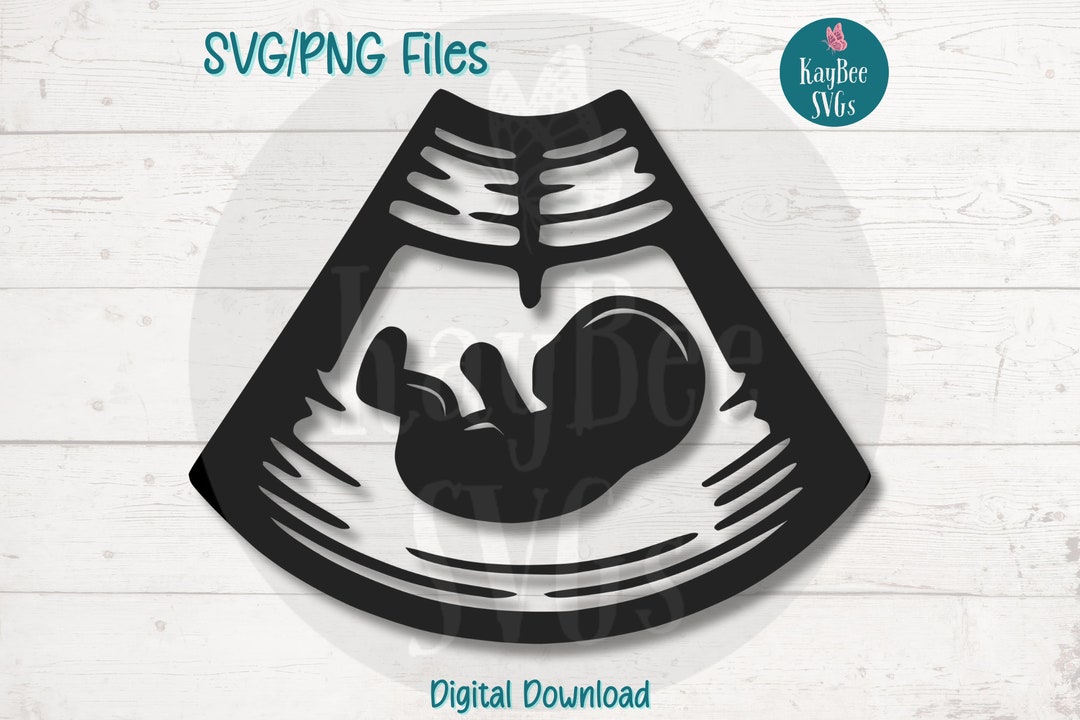 Baby Sonogram SVG | PNG Cut Files for Cricut, Silhouette, Digital ...