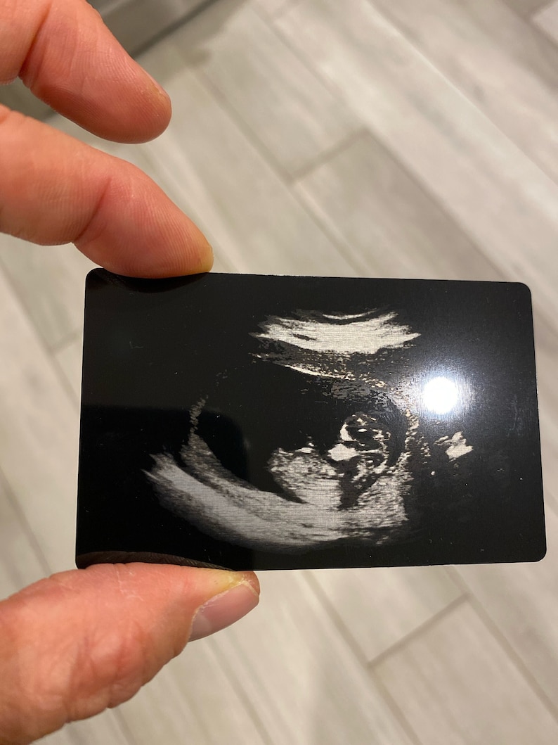 Baby Scan Photo Card, Baby Scan Gift Metal Wallet Photo Card, New Dad ...