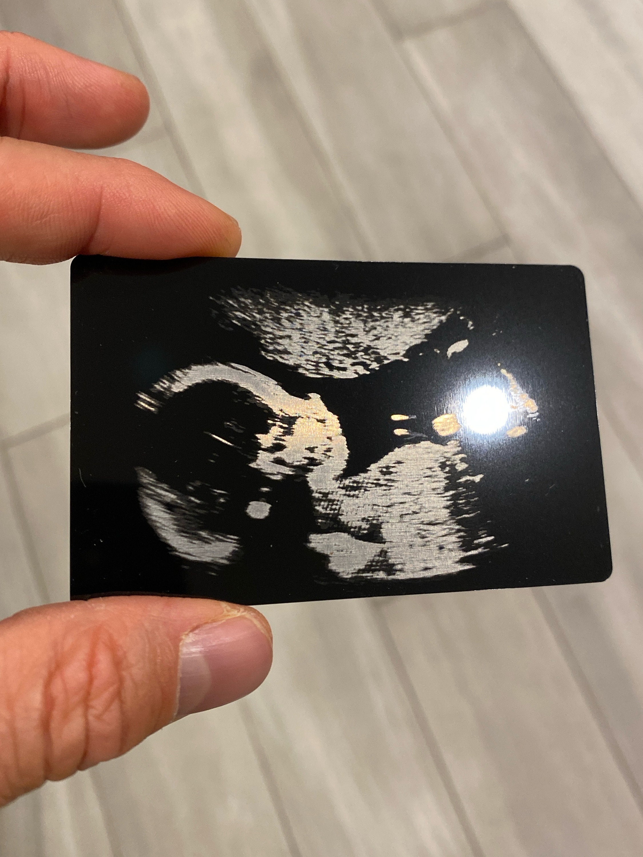 Baby Scan Photo Card, Baby Scan Gift Metal Wallet Photo Card, New Dad ...