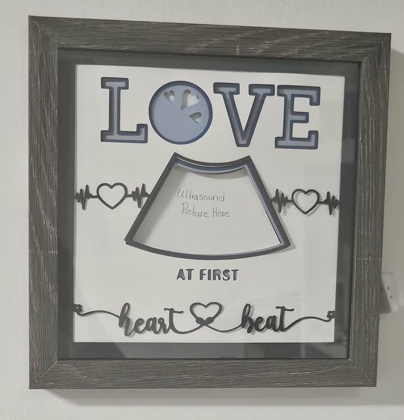 3D Lighted Ultrasound Shadow Box - Etsy