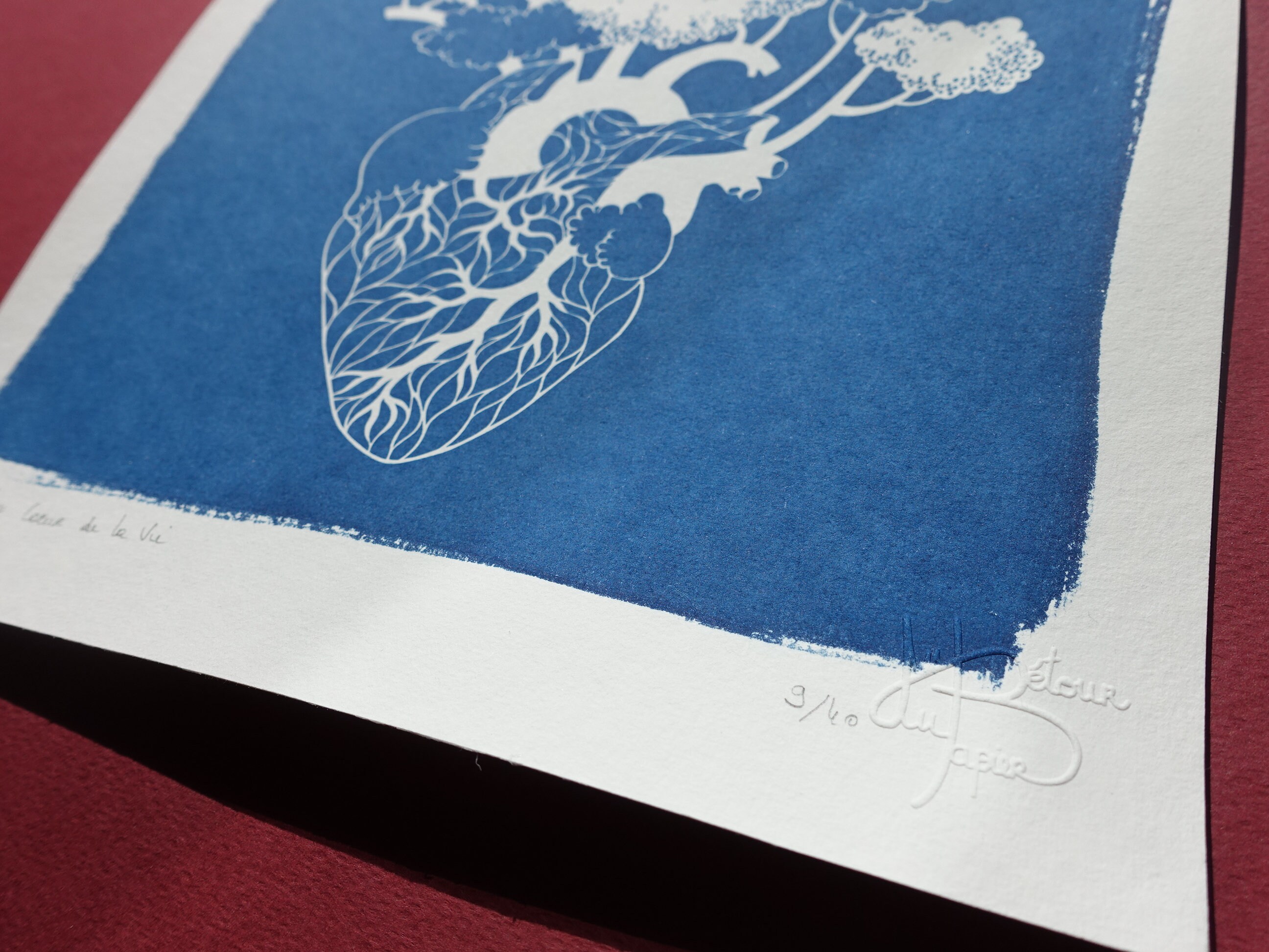 Original Cyanotype, Tree of Life Wall Art, Heart Anatomy Art, Nurse ...