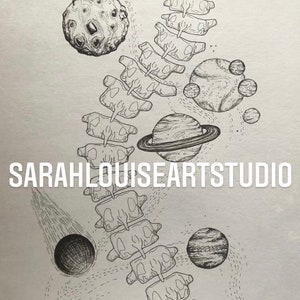 A4 Custom Hand Drawing Spinal Fusion / Scoliosis (one Line Drawing ...
