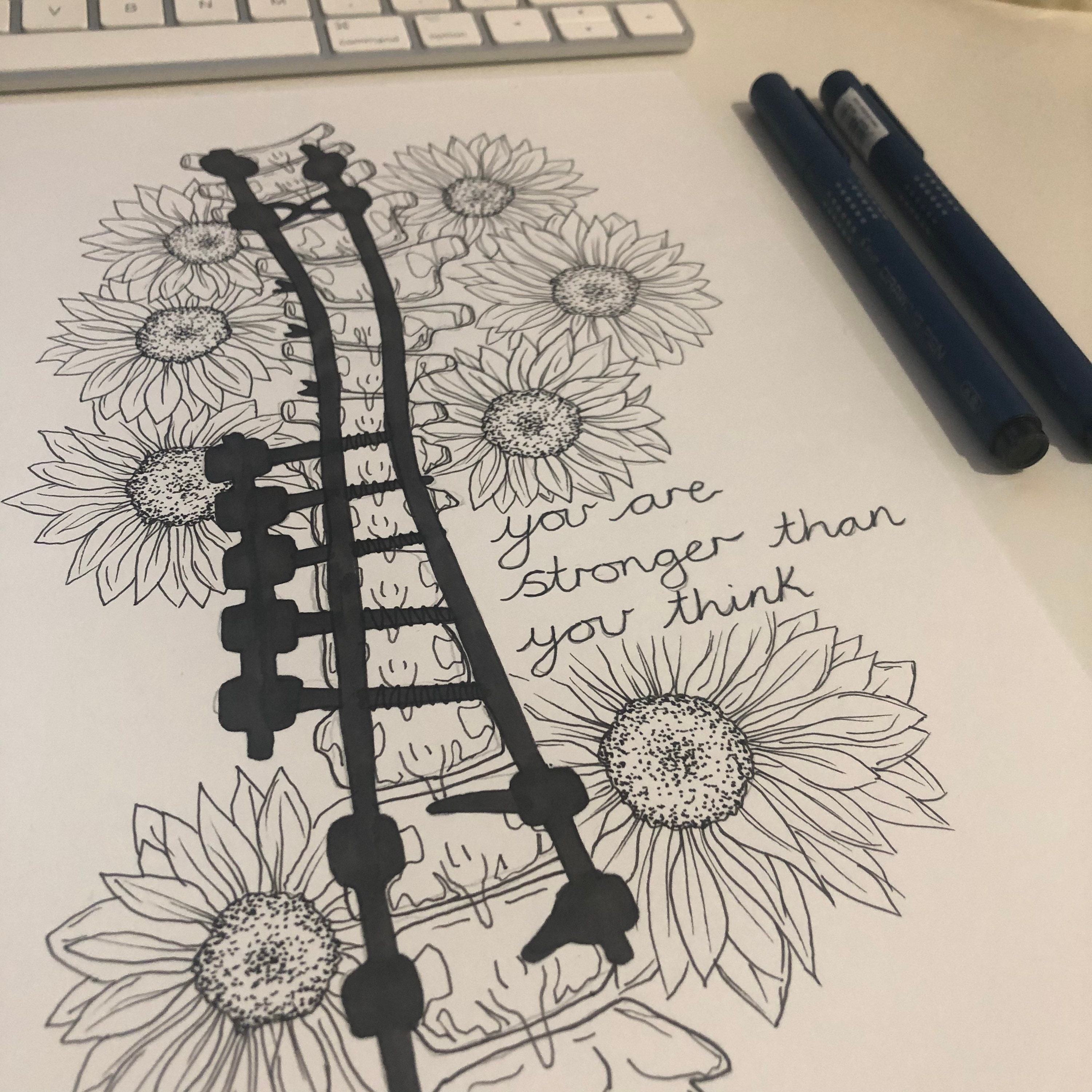 A4 Custom Hand Drawing Spinal Fusion / Scoliosis (one Line Drawing ...