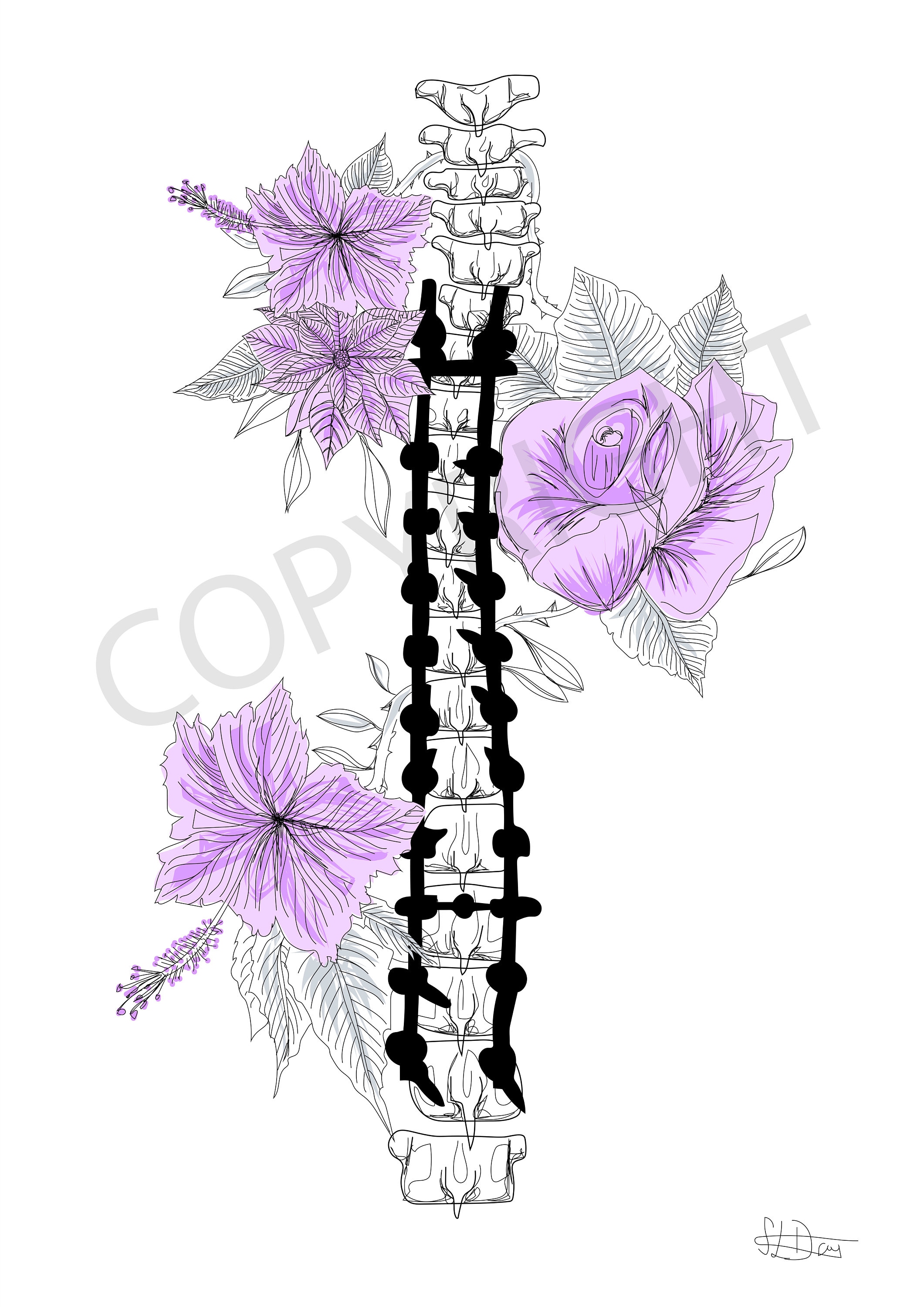 Custom Digital Floral Scoliosis / Spinal Fusion Digital Art | Etsy