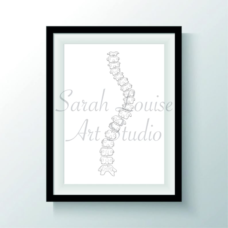 Custom Scoliosis / Spinal Fusion Digital Art Print PRINTABLE File ...