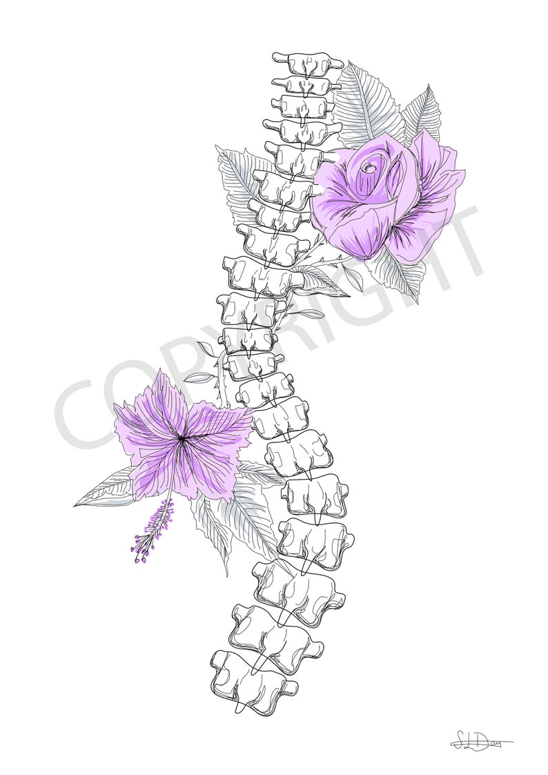 Custom Digital Floral Scoliosis / Spinal Fusion Digital Art | Etsy