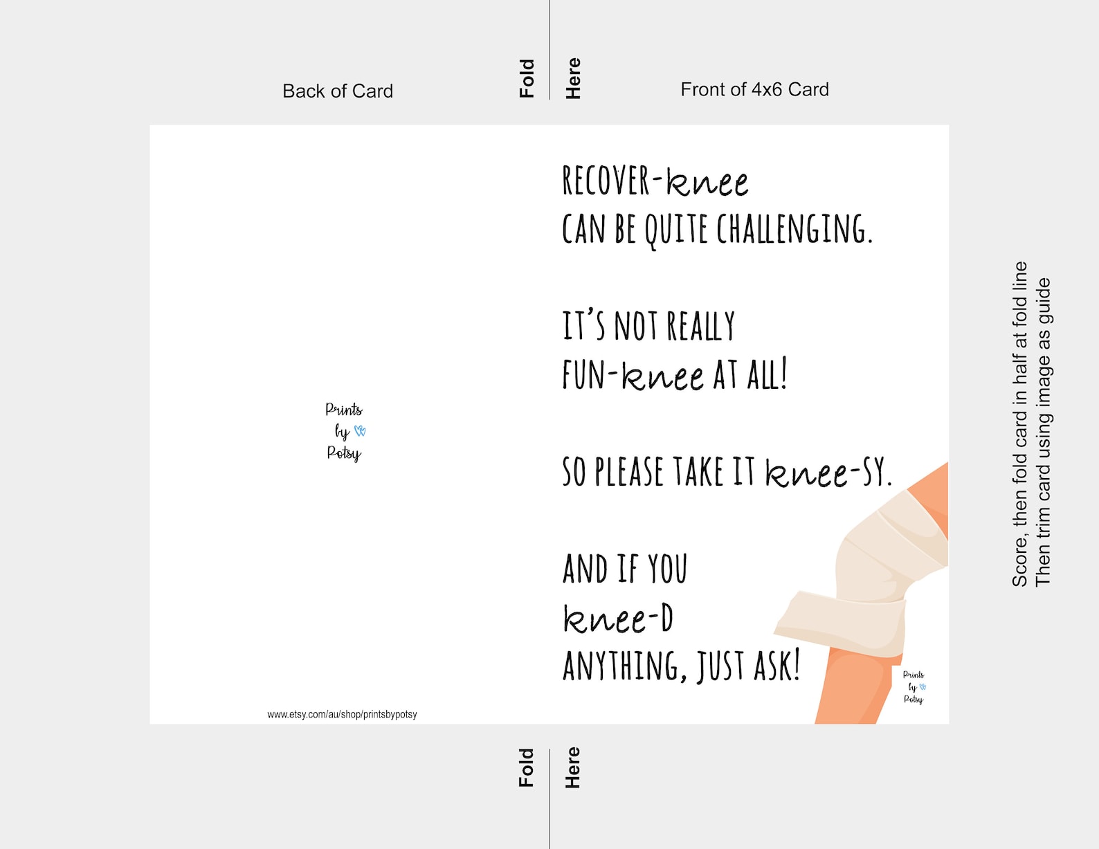 Printable Knee Operation Card, Knee Surgery Card, Knee Replacement Card ...