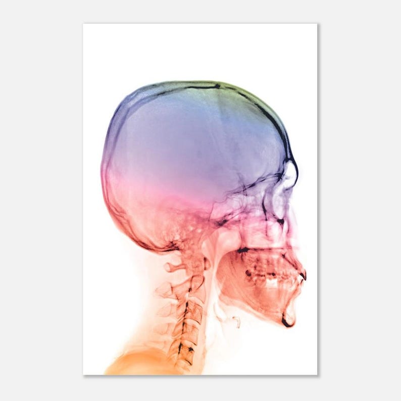 Physiotherapy Clinic Wall Art Poster Pack, Colourful Human X-ray - Etsy