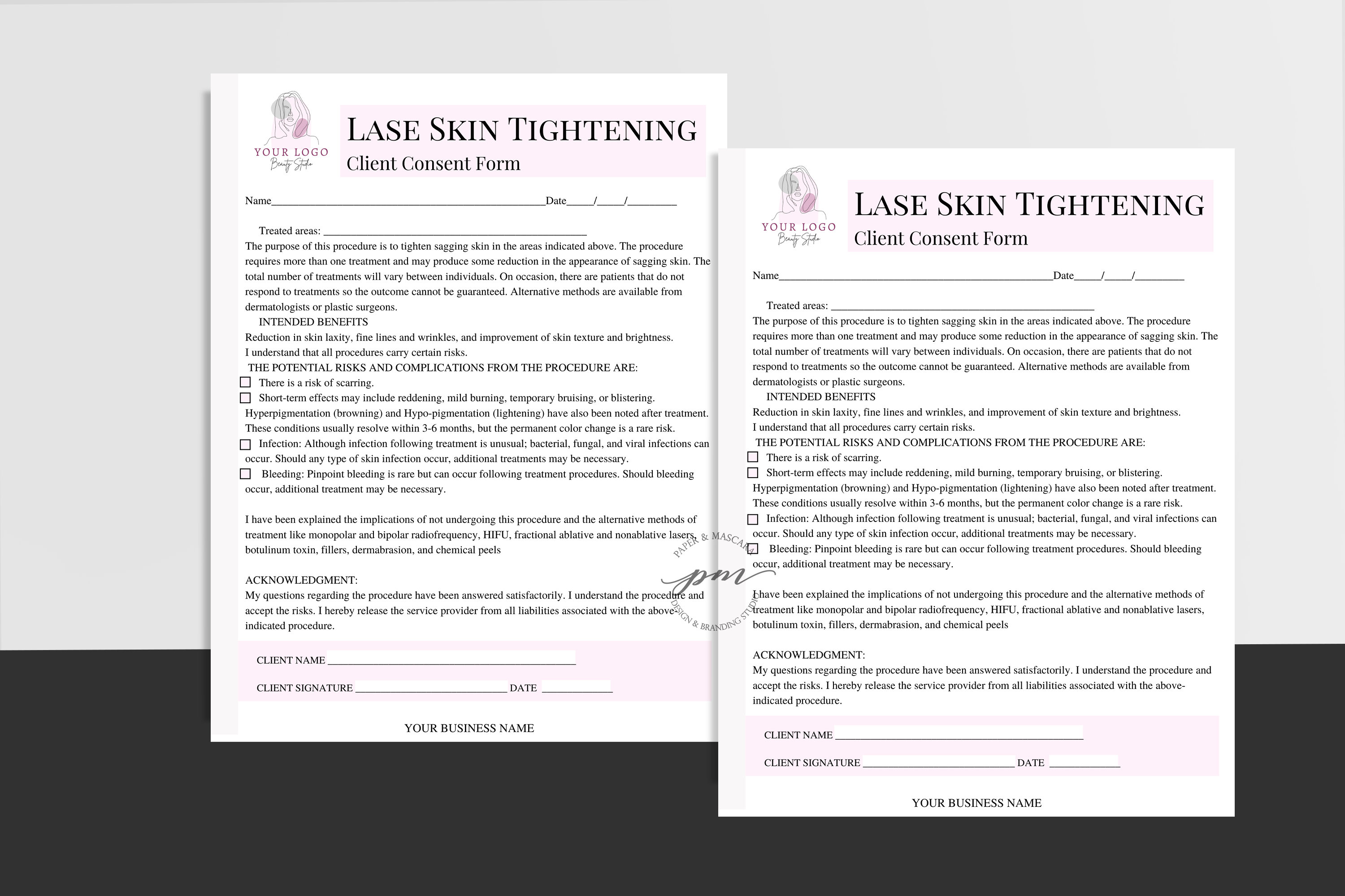 Laser Skin Tightening Consent Form Template Editable Laser | Etsy