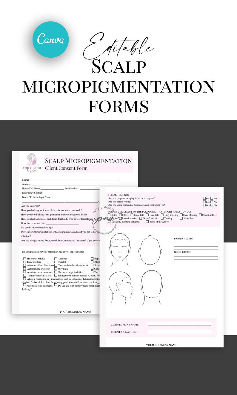 Editable Scalp Micropigmentation Form Template, Scalp Micropigmentation ...