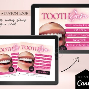 Editable Tooth Gem Flyer Template, Tooth Charms Instagram Post, Dental ...