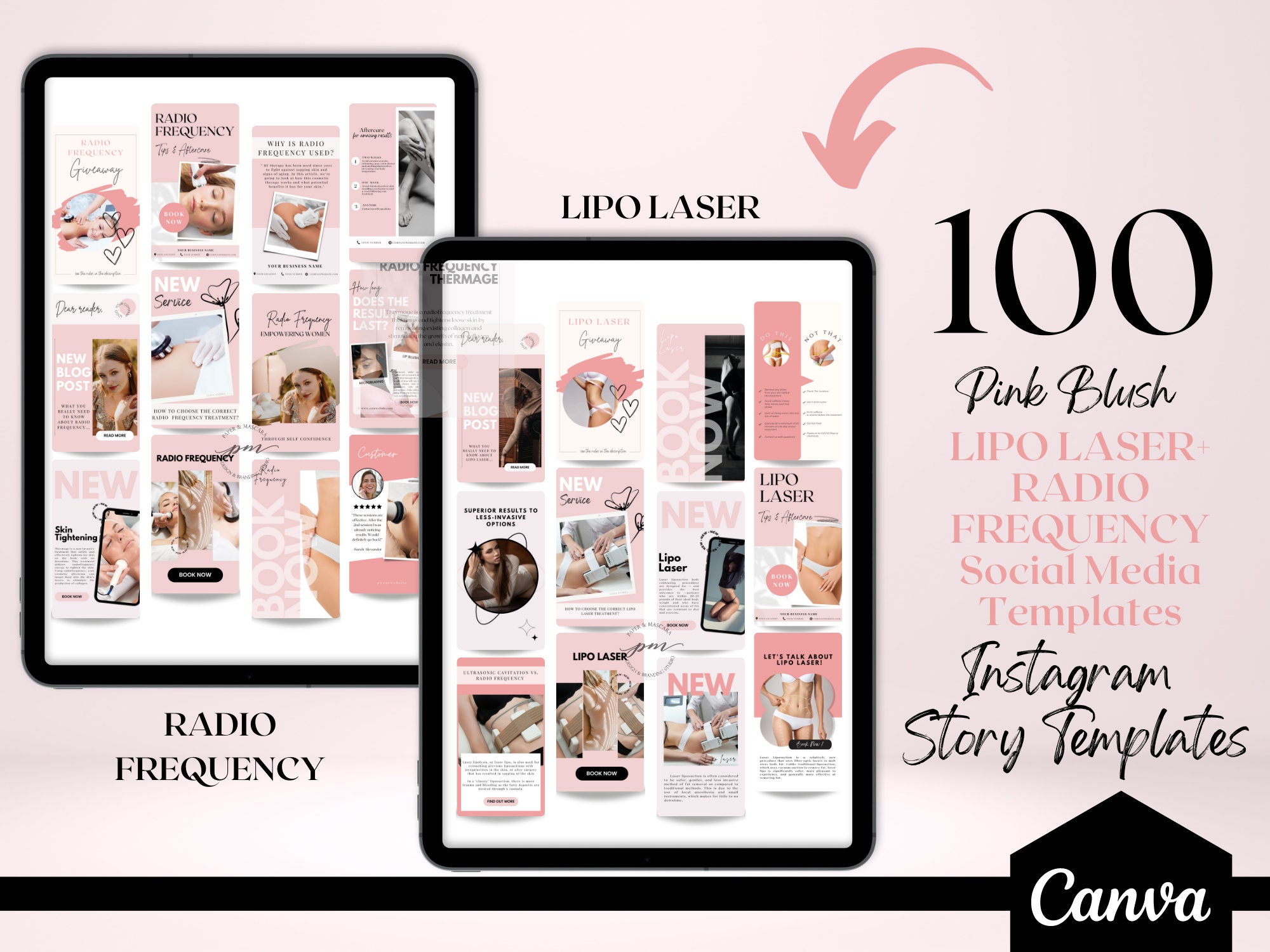 300 Body Contouring Instagram Story Templates, Lipo Laser, Radio ...