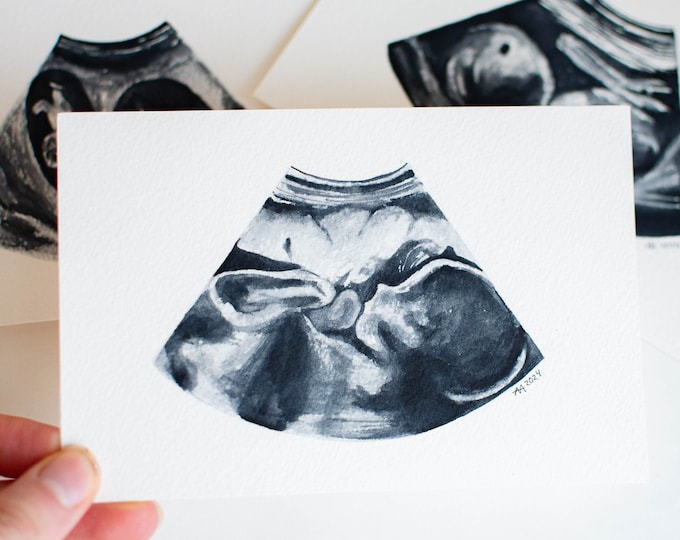 Watercolor Ultrasound Painting, Custom Sonogram, Ultrasound Painting ...