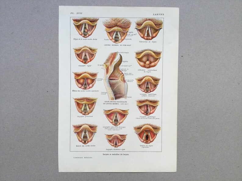 Larynx Anatomy of the Larynx, Diseases of the Larynx, Human Body Human ...