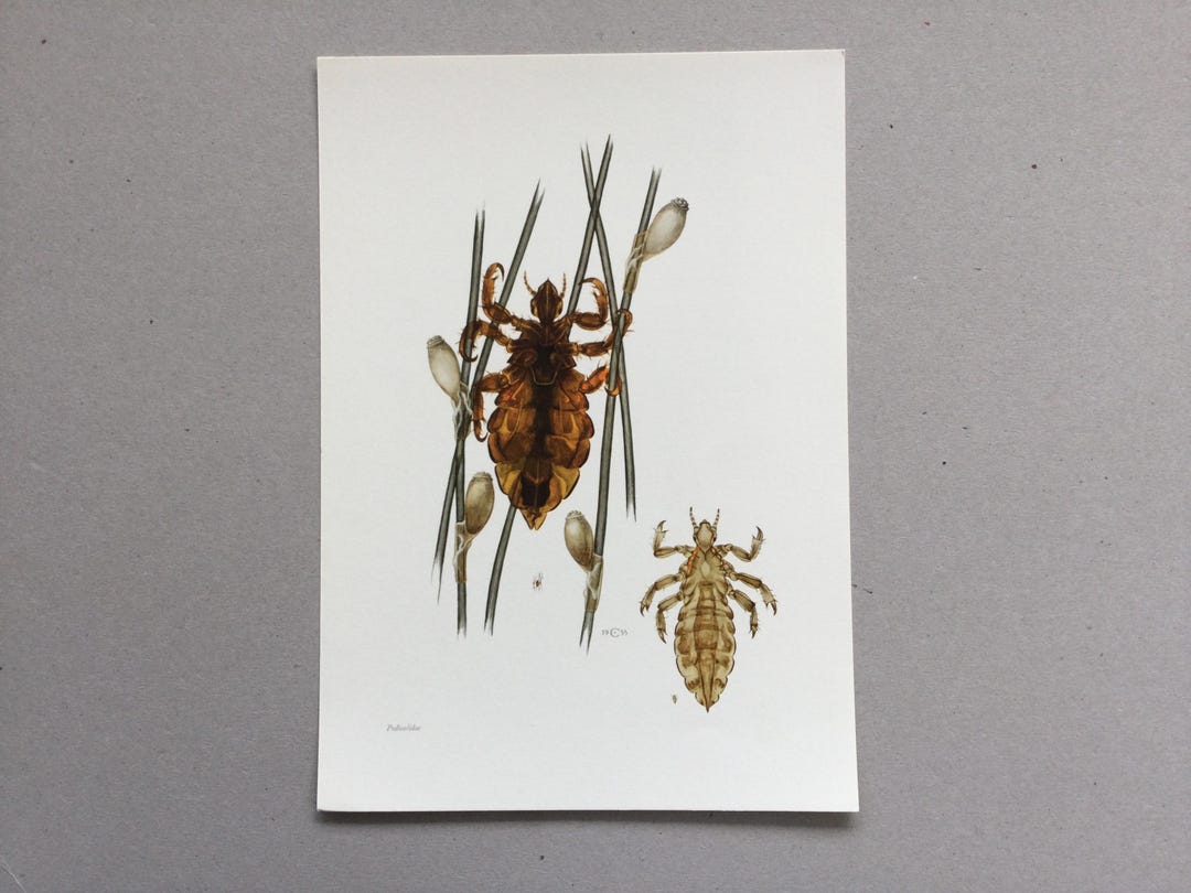Insects Louse, Head Louse, Body Louse, Insect Prints, Vintage Insect ...