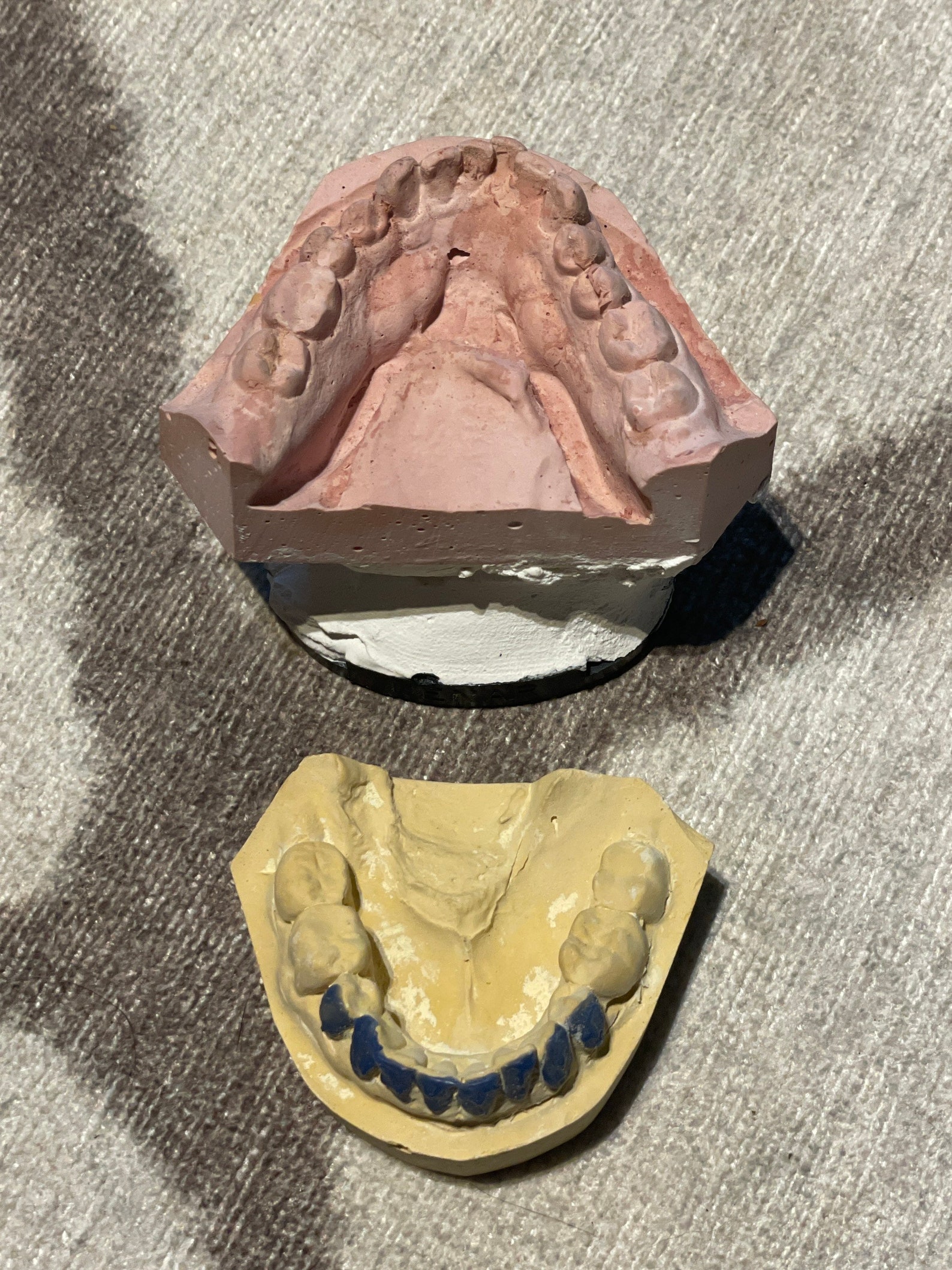 Vintage 1980s Plaster Dental Mold Anatomical Model, Informative Display ...