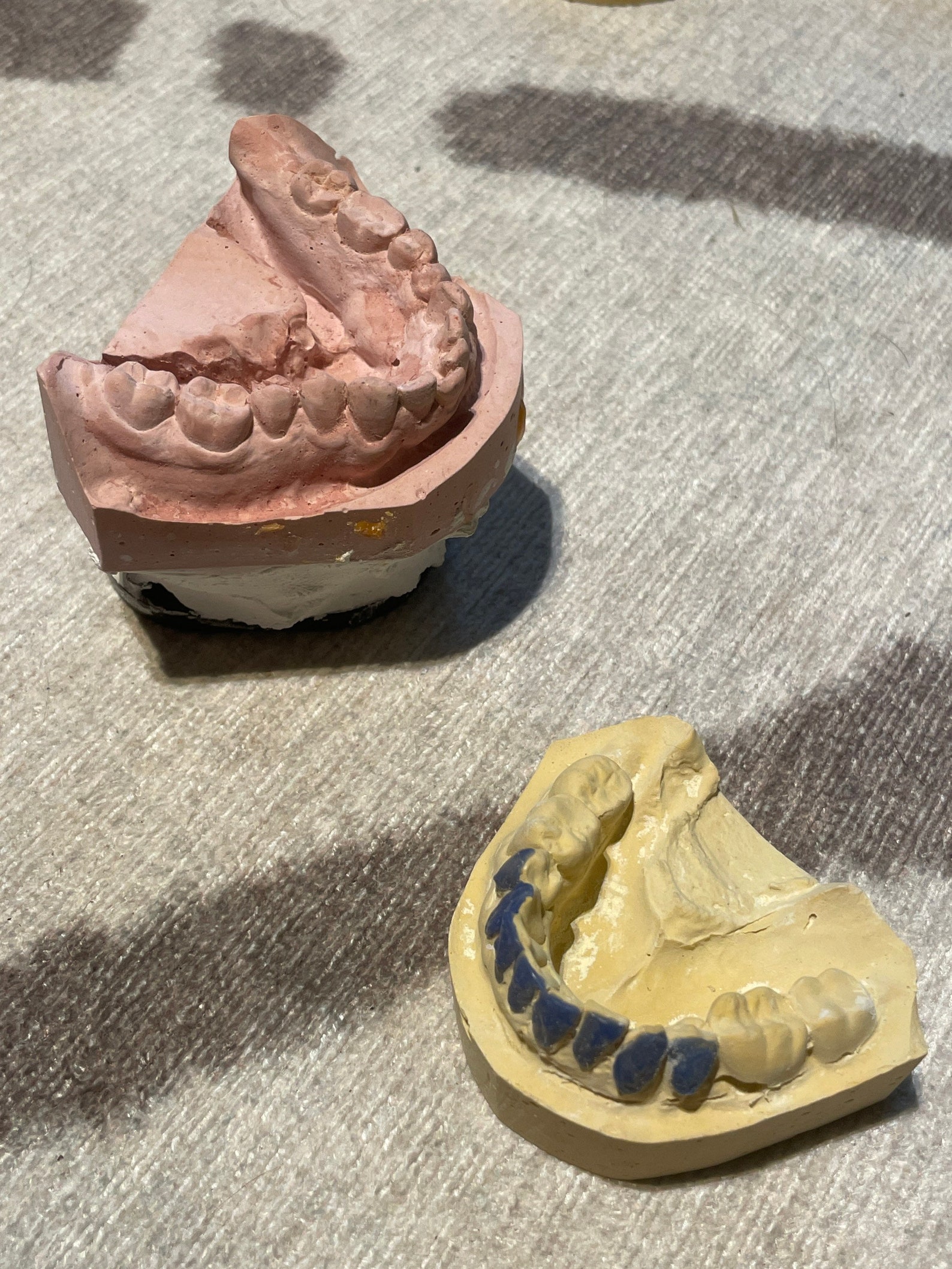 Vintage 1980s Plaster Dental Mold Anatomical Model, Informative Display ...