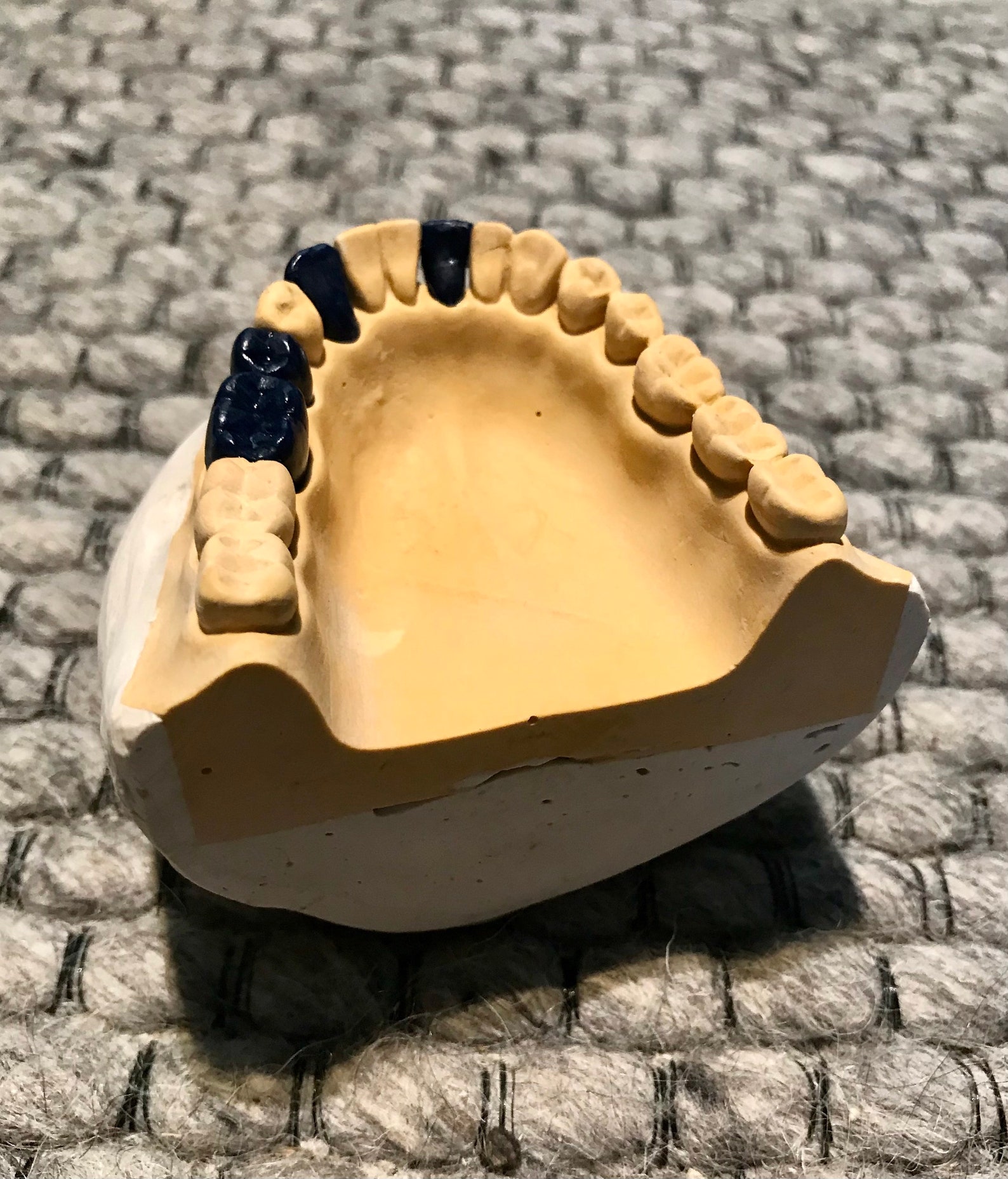 Vintage 1980s Plaster Dental Mold Anatomical Model | Etsy