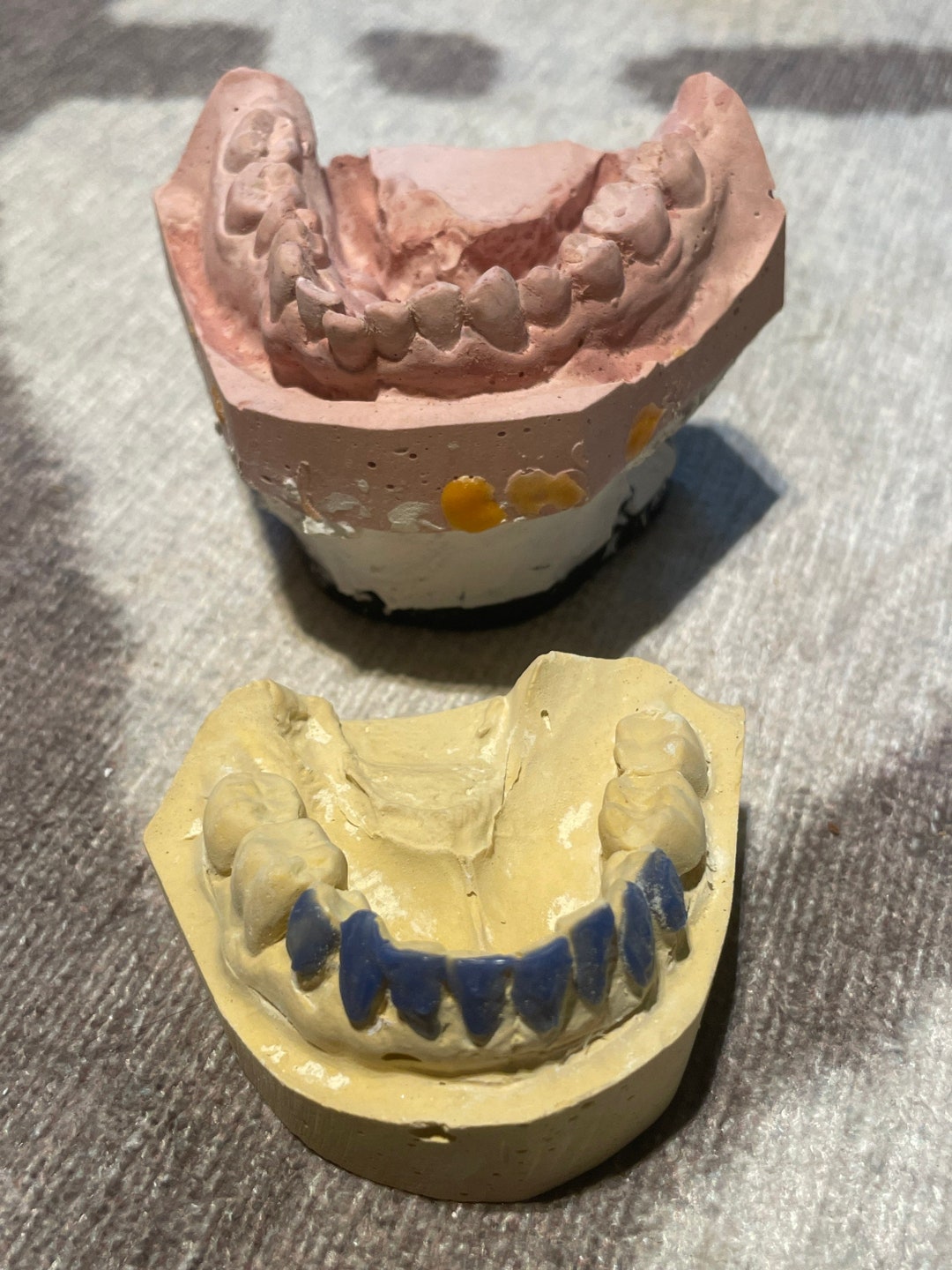 Vintage 1980s Plaster Dental Mold Anatomical Model, Informative Display ...