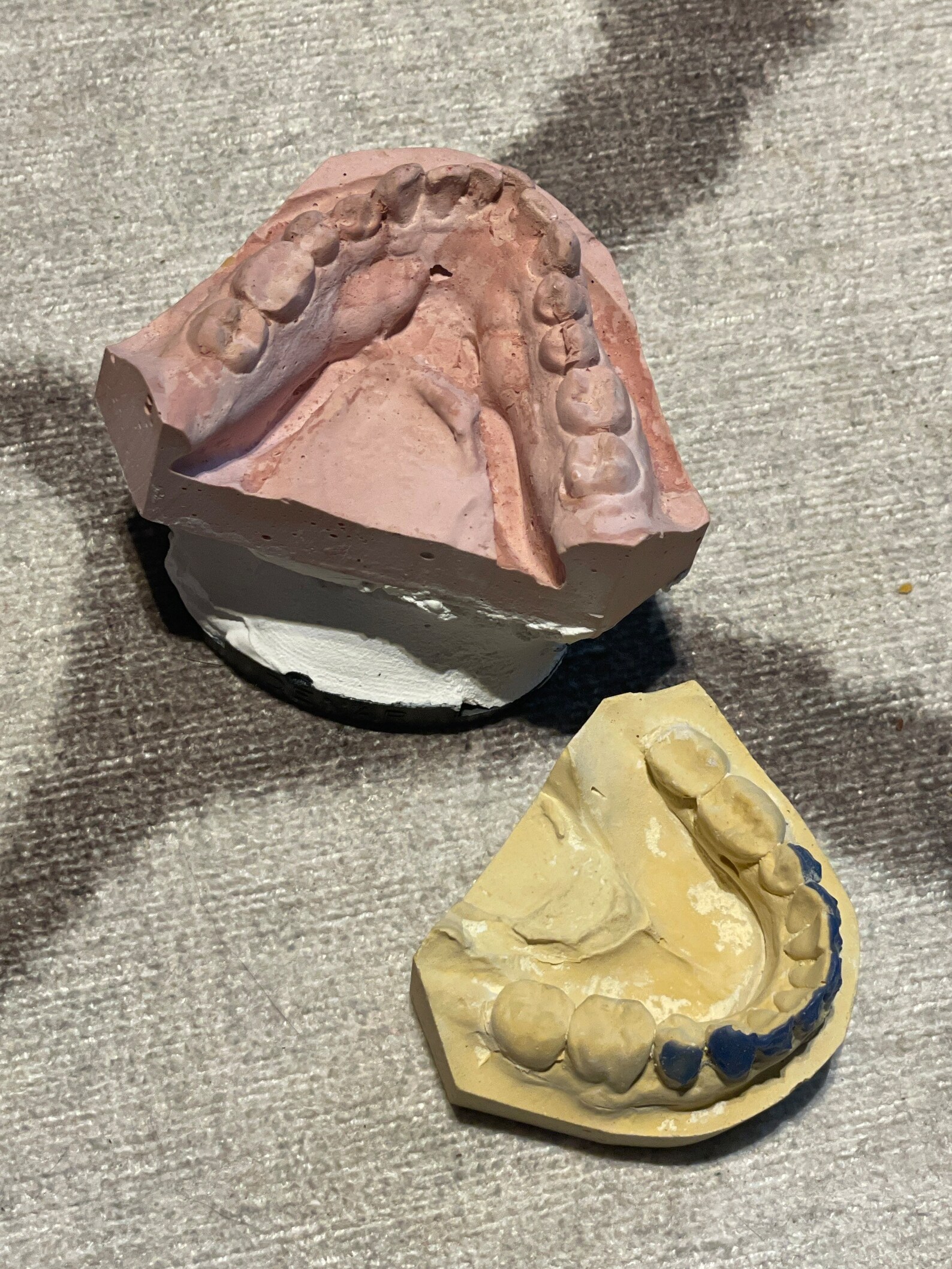 Vintage 1980s Plaster Dental Mold Anatomical Model, Informative Display ...