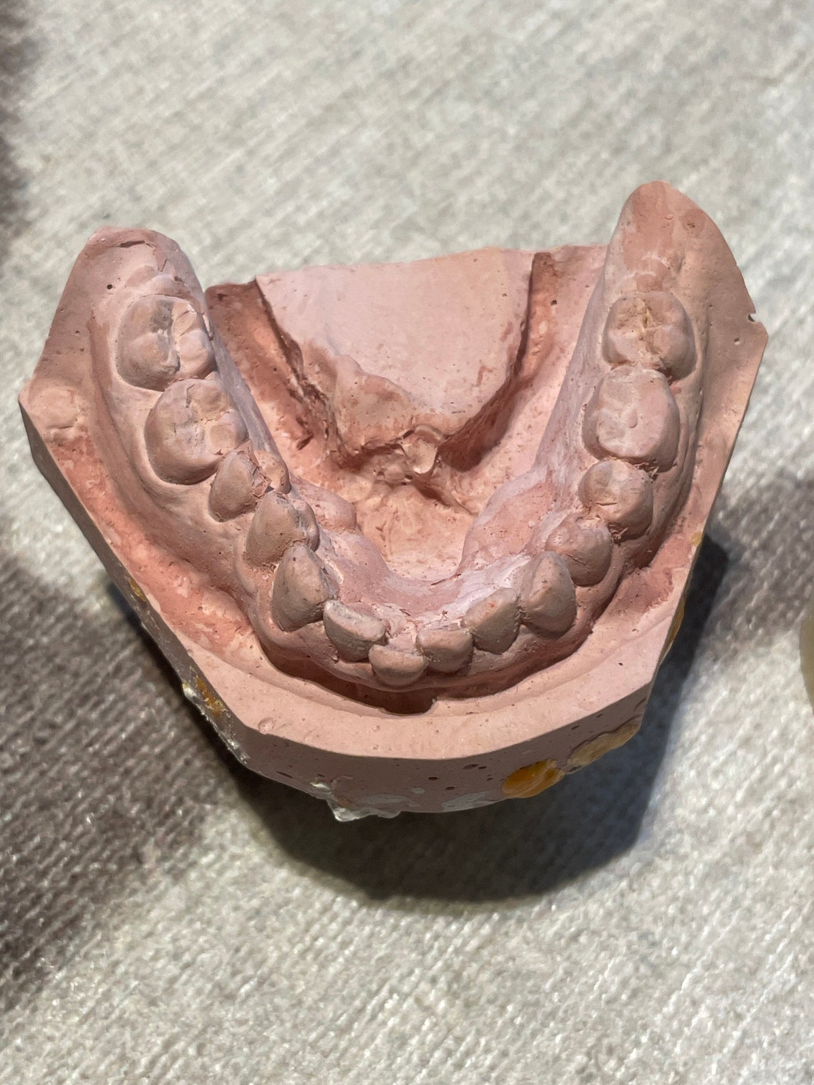 Vintage 1980s Plaster Dental Mold Anatomical Model, Informative Display ...