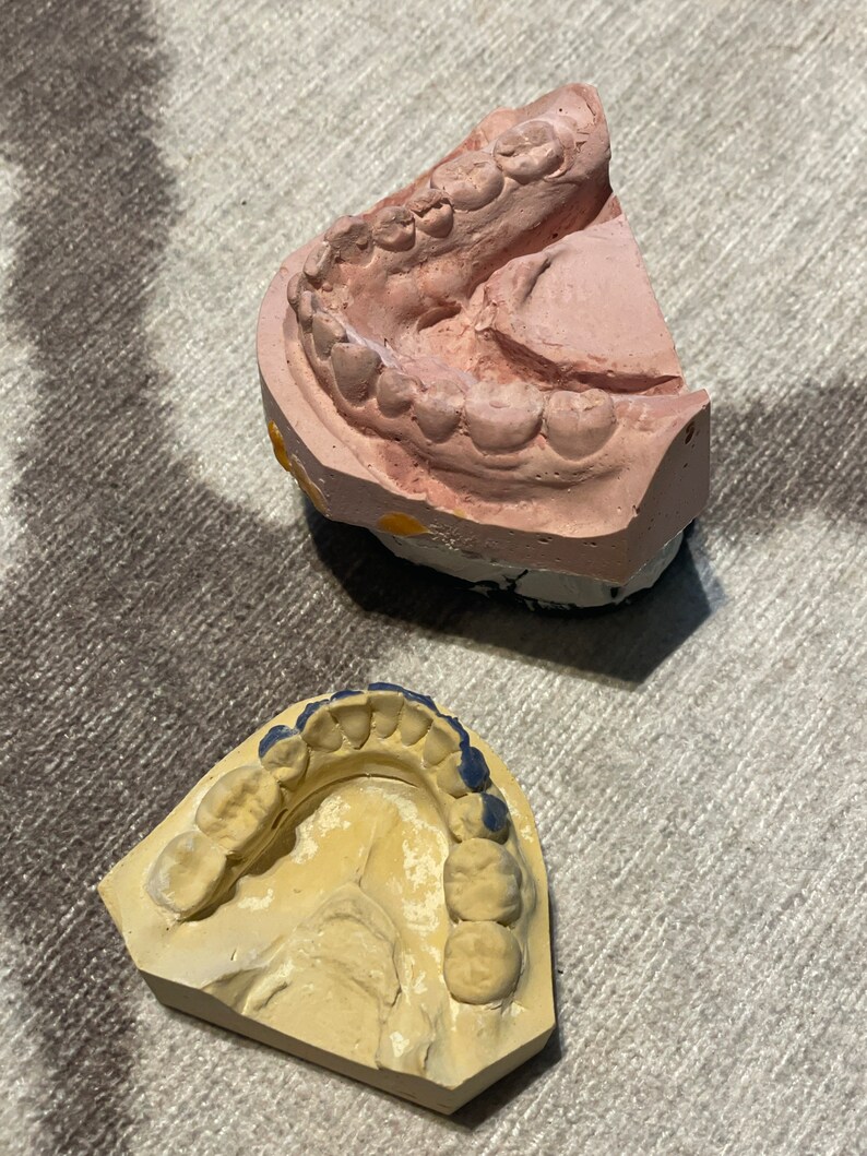 Vintage 1980s Plaster Dental Mold Anatomical Model, Informative Display ...