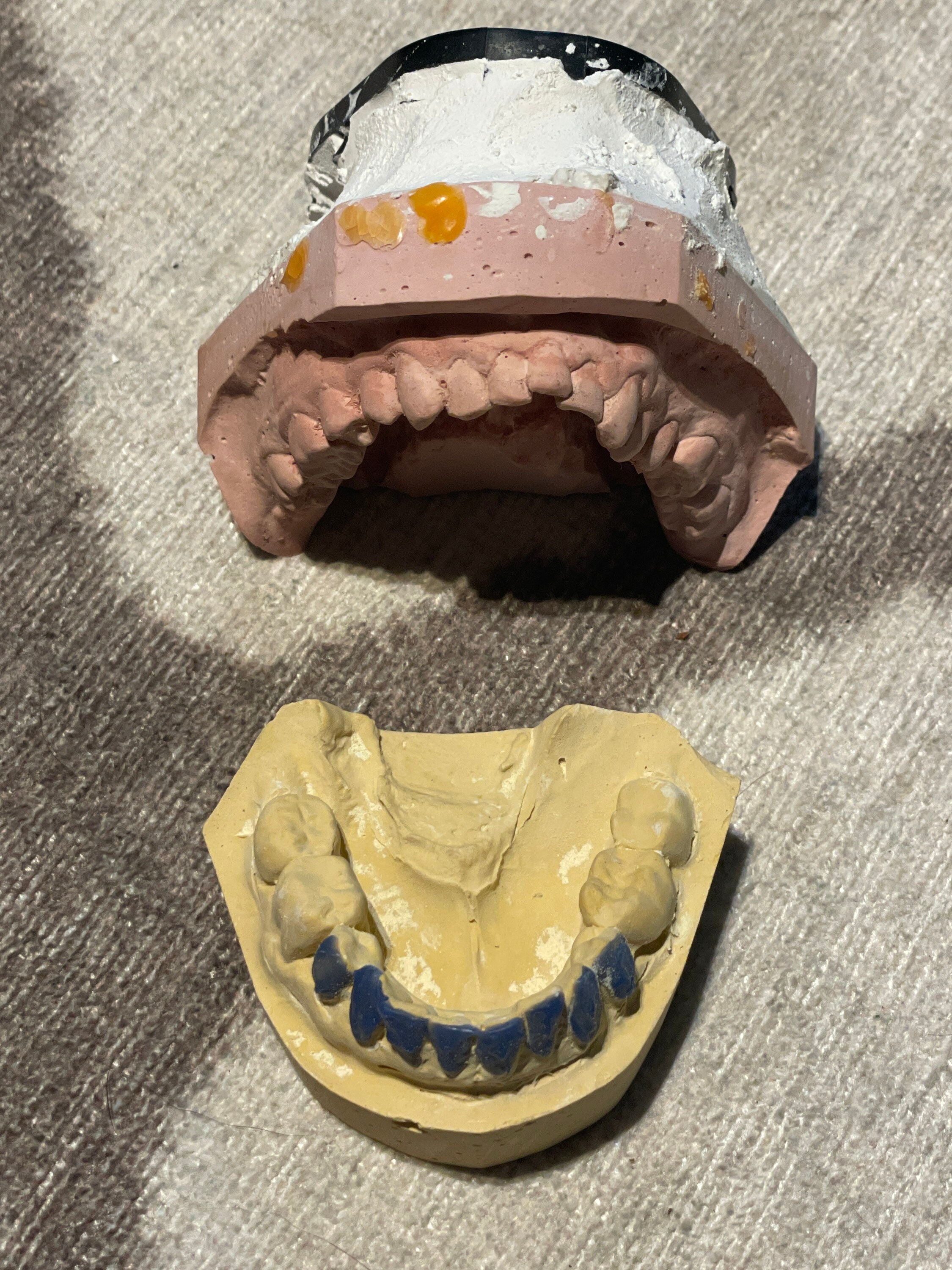 Vintage 1980s Plaster Dental Mold Anatomical Model, Informative Display ...