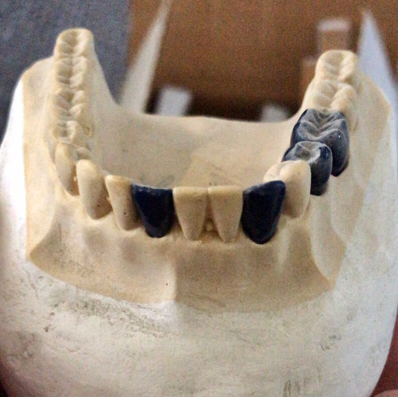 Vintage 1980s Plaster Dental Mold Anatomical Model - Etsy